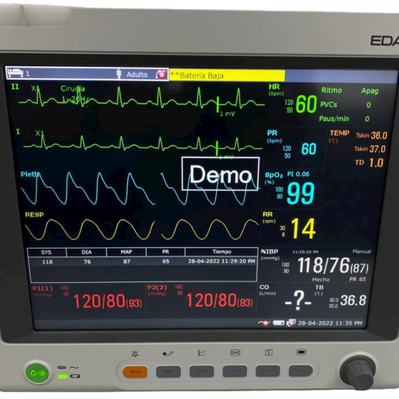 Monitores multiparámetros archivos - Nova Médica